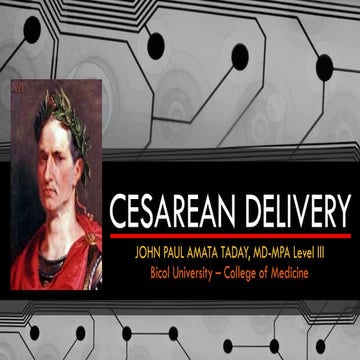 Cesarean Delivery | PDF