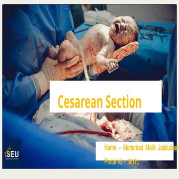 Cesarean Section by Mohamad Cesarean Section 36111.pptx
