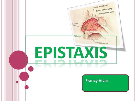 Epistaxis | PPT