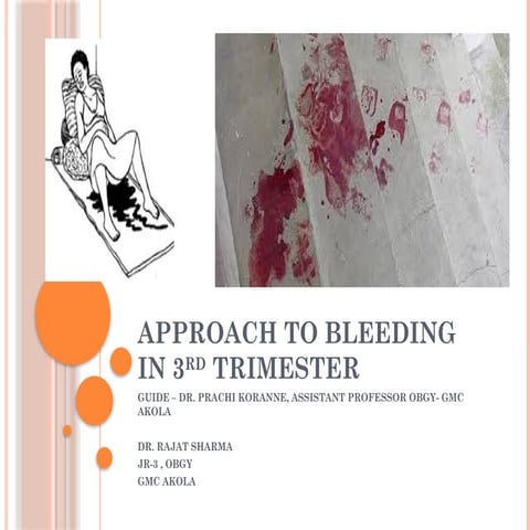 APPROACH_TO_BLEEDING_IN_3RD_TRIMESTER.pptx