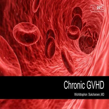 Graft versus host disease | PPTX