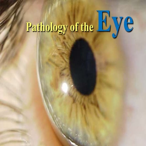 Ch29-Eye pathology of eye..Chapter 19 .ppt