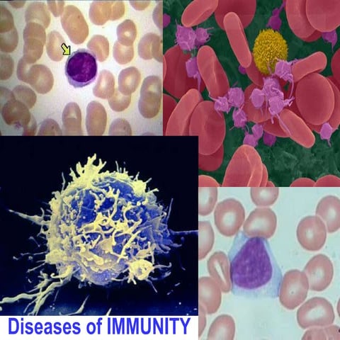 TYPE IV HYPERSENSITIVITY | PPTX