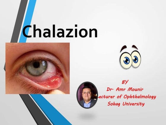 diagram of eye | PDF