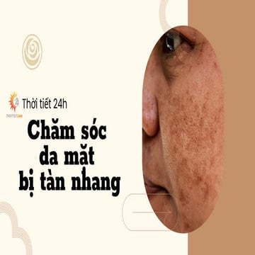 cham-soc-da-mat-bi-tan-nhang | PPT