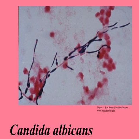 Discovery of candida | PPTX