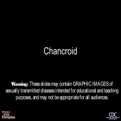Chancroid | PPT