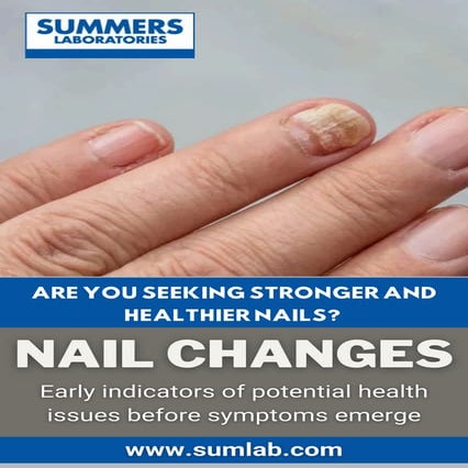 What do nail changes indicate? Changes in nails | PDF