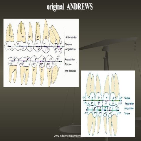 Changing trends in preadjusted edgewise system /certified fixed ...