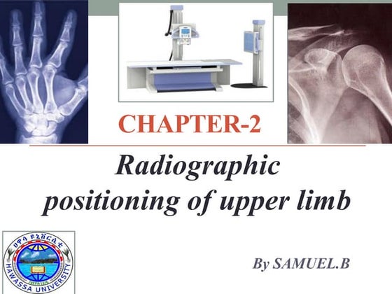 Upper limb radiography | PPTX
