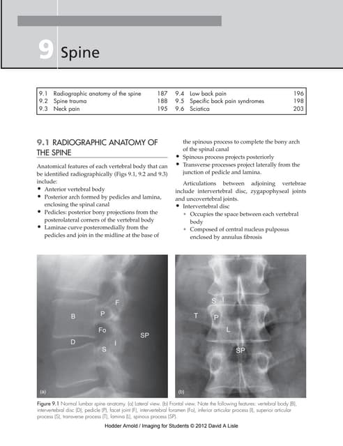 Atlas(C1) & Axis(C2) Vertebrae.pptx | Death, Injury, or Military Conflict | Sensitive Topics