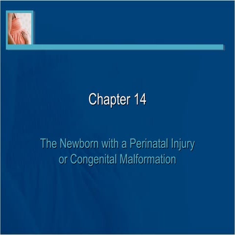 Chapter 014 lo | PPT