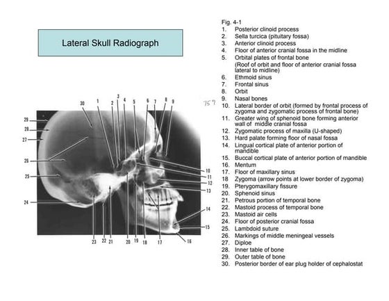 Muscles attached to the mandible | DOCX