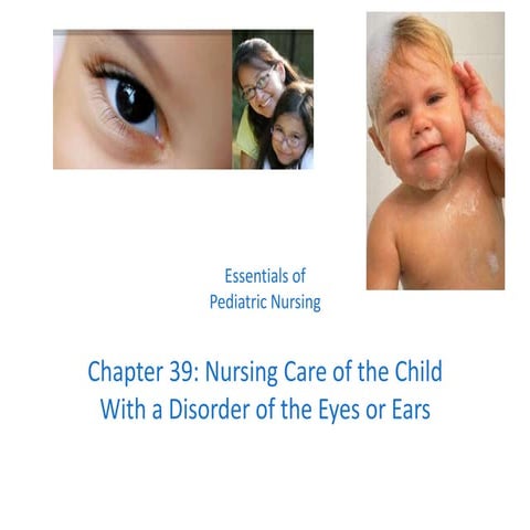 Chapter 39 Nursing Care of the Child with a Disorder of the Eyes or ...