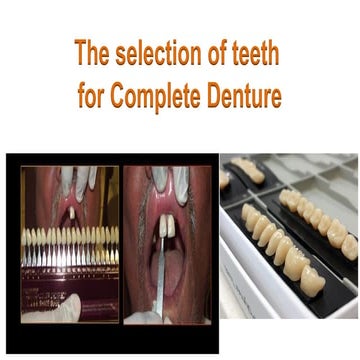 Teeth selection for complete denture | PDF