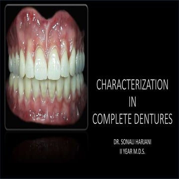 Characterization in complete dentures | PPTX