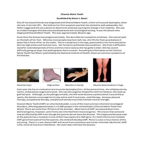 Charcot marie tooth | PDF