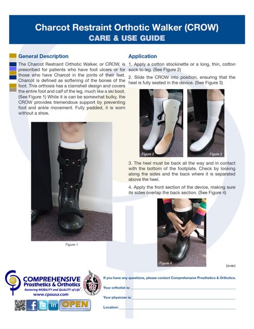 Lumbar Scaral Orthosis & Thoracic Lumbar Sacral Orthosis (LSO/TLSO ...