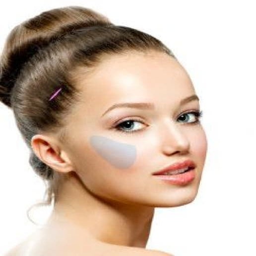 Neck lift-633x300 | PDF