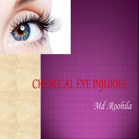Chemical eye injuries ruhi.pptx
