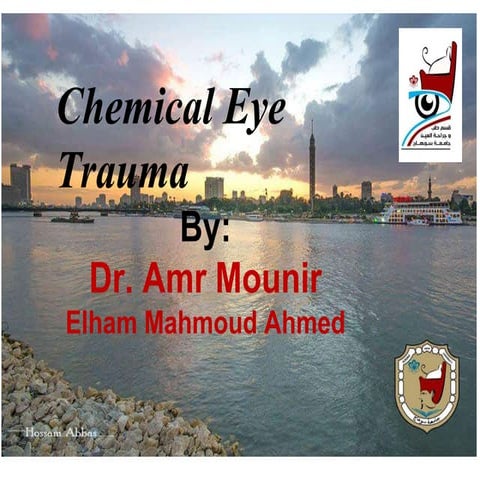 Chemical eye trauma | PPTX
