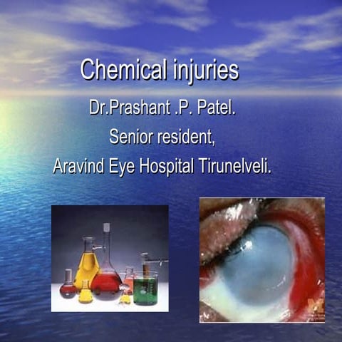 Ocular chemical injuries | PPT