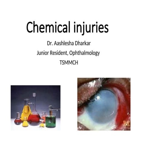 CHEMICAL INJURIES of the EYE and its management | PPT