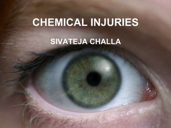 Ocular Chemical Injury | PPTX