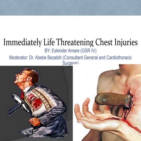 Chest 12. Chest Trauma.pptx