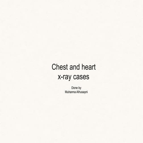 Chest and heart cases MD osce.pdf
