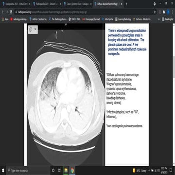 CHESTcases.pptx | Lung and Respiratory Health | Diseases and Conditions
