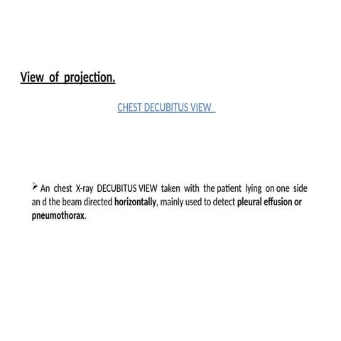 Chest radiography ppt | PPTX