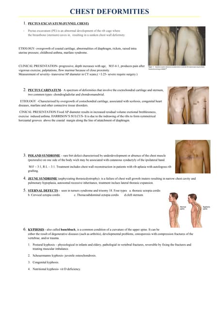 CHEST WALL DEFORMITY | PPTX | Lung and Respiratory Health | Diseases and Conditions