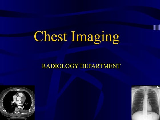 Approach to ct chest 578 | PPT | Lung and Respiratory Health | Diseases ...