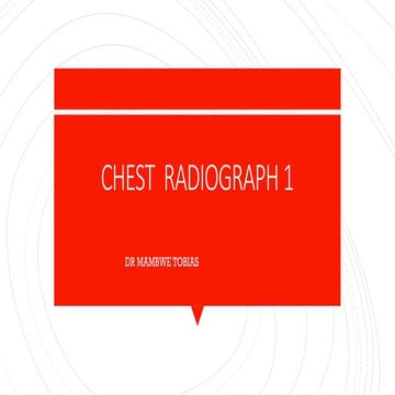 Chest radiography ppt | PPTX