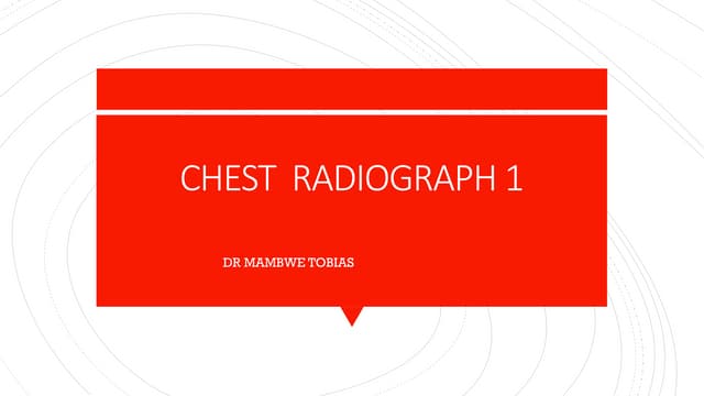 Chest radiography ppt | PPTX