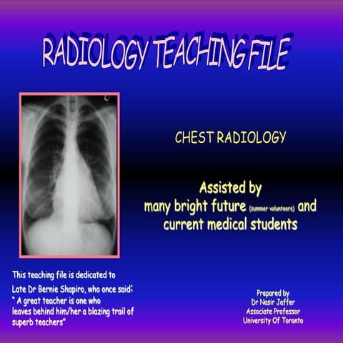 Learn Chest X-Ray With Its Normal Positioning & Radio-Anatomy | PPTX