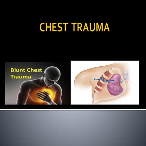 chest trauma on duty warzone PS4 controller | PDF