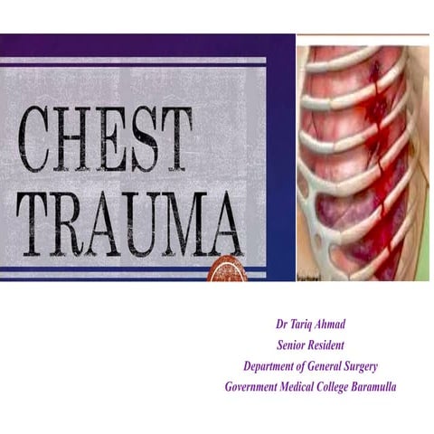 Chest trauma, introduction, summary and results | PPTX