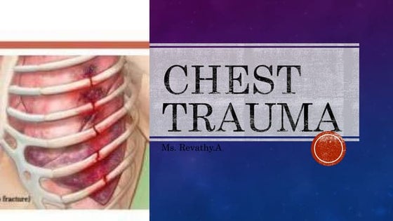Flail chest | PPTX