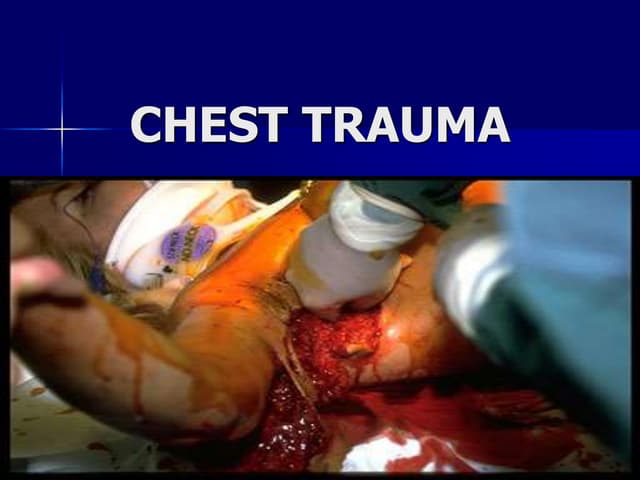 Chest injury and nursing care | PPTX