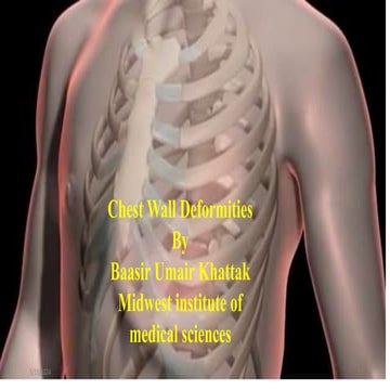 Chest wall deformity by Baasir Umair Khatak.pptx
