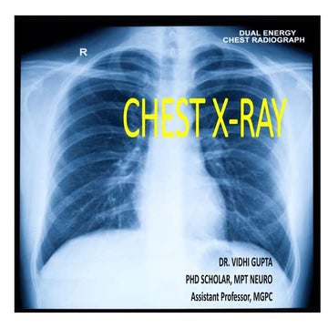 CHEST X-RAY.pptx