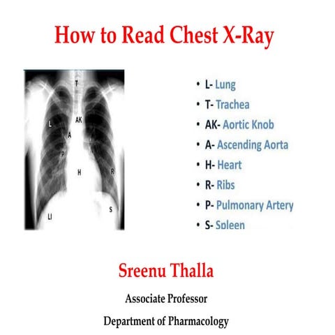Understanding and Reading of Chest X-Rays | PPTX