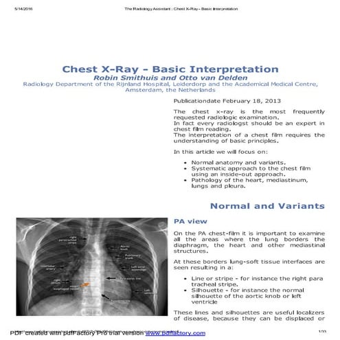 Basics of Chest X Ray Reading