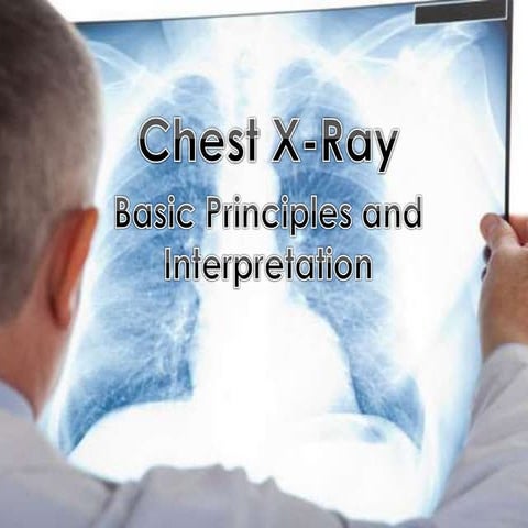 Chest x ray - basic principles and interpretition | PPTX