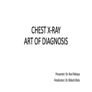 CHEST X-RAY, art of diagnosis.pptx SA SA S S S | PPTX