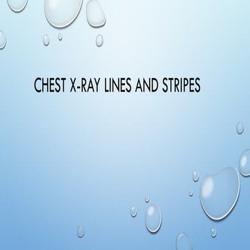 Chest x-ray Lines and stripes.pptx useful for residents | PPTX
