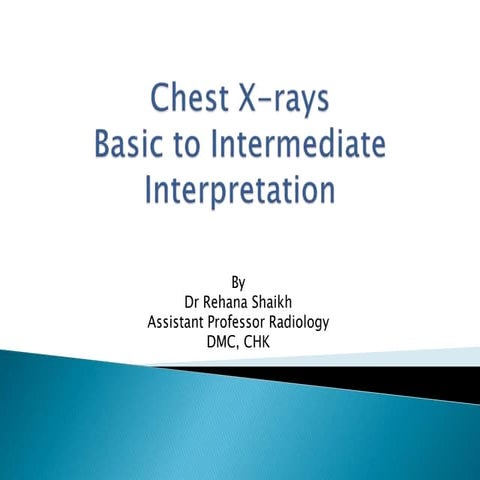 Chest X-ray radiology_Power Point Presentation | PPTX