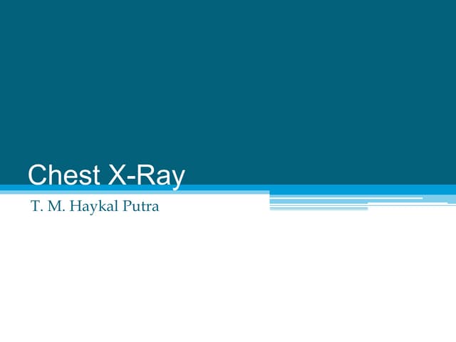 Bagaimana cara membaca foto rontgen/x-ray | PPT